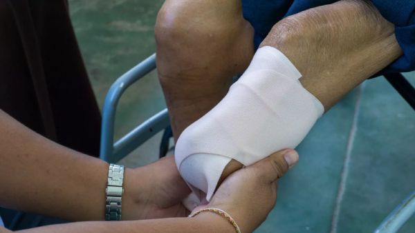 சிசேரியனில் ஏற்பட்ட தொற்று! குழந்தை பிறந்த இரண்டே நாட்களில்.. தாய்க்கு ...