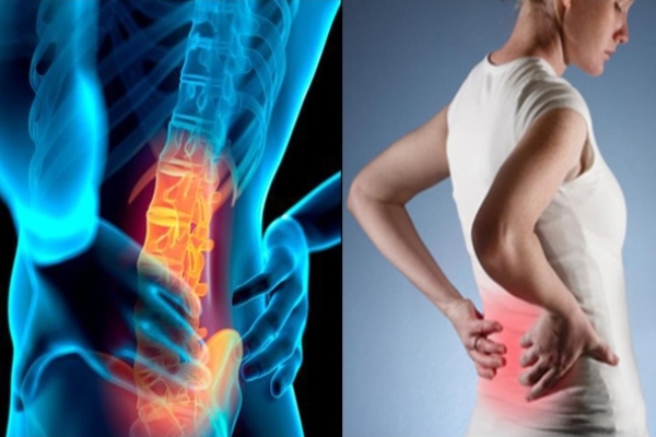 சிசேரியன் பிரசவத்திற்கு பிறகு ஏன் முதுகுவலி வருகிறது...சரிசெய்ய சில ...