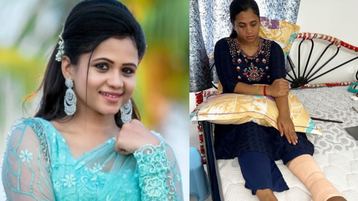 காலில் அடிபட்டு கட்டுடன் விஜே மணிமேகலை.. சோகத்தில் பதிவு.. இந்த நிலைமை ...